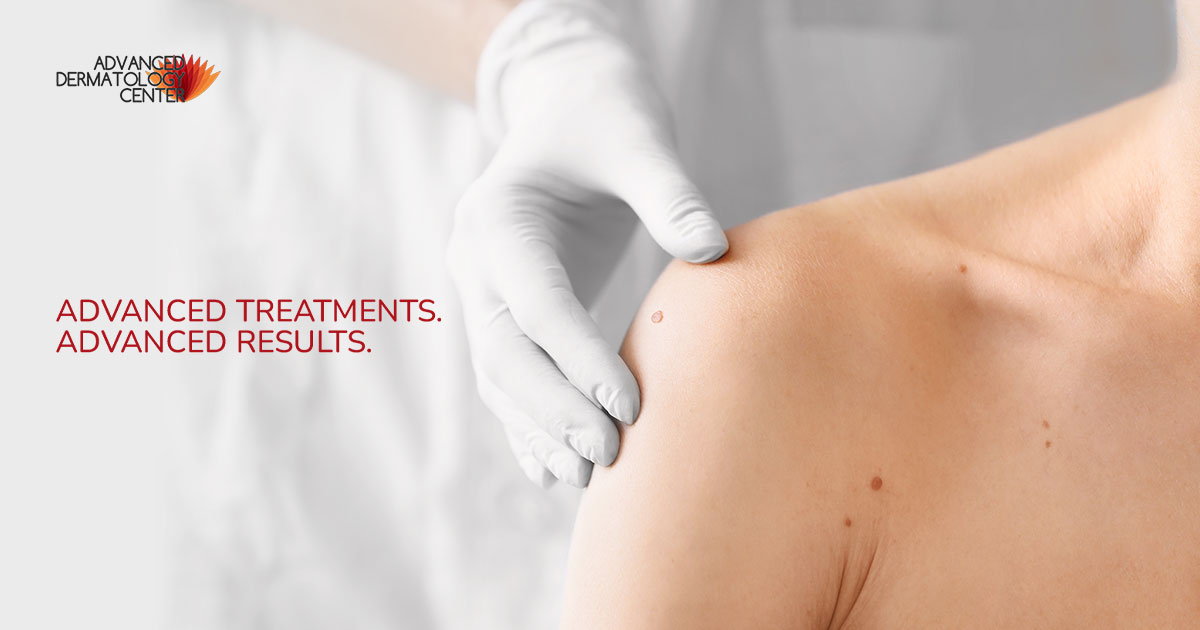 Meet Our Team | Advanced Dermatology Center